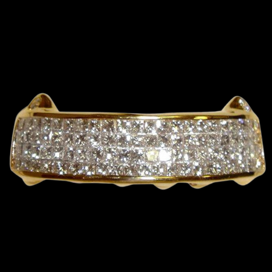 Kanye Wests Choice Grillz – TYS GRILLZ